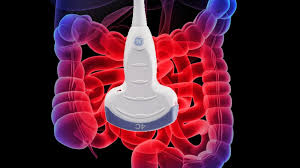 INTESTINAL ULTRASOUND - USEFUL? - GastroNorth